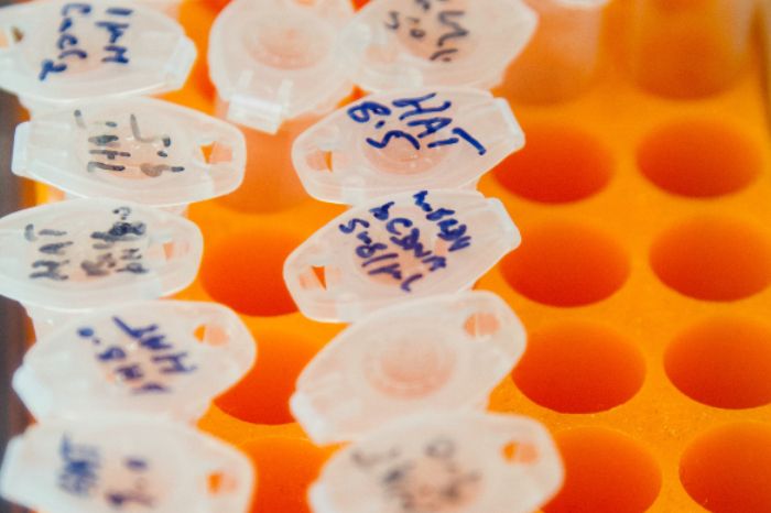 NEJM publishes key Gazyva data in lupus nephritis | Biotechnology | The ...